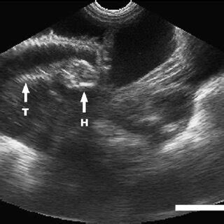 Ultrasonographic Image Of The Uterine Horn In A Pregnant Peccary Female