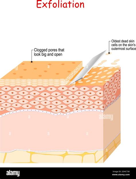 Exfoliation Diagram