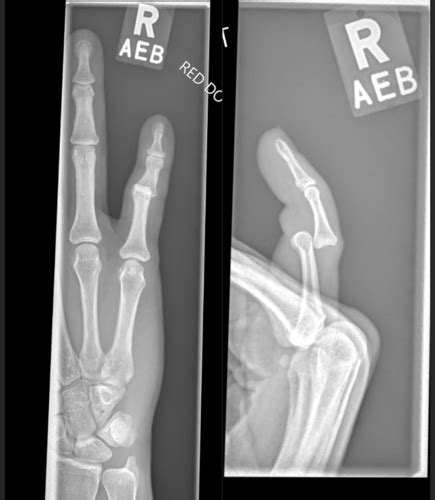 Imaging Of The Locomotor System Flashcards Quizlet