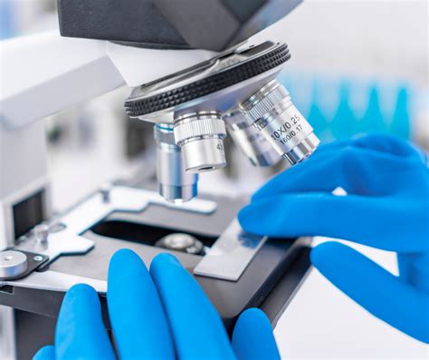 Biopsia Prostatica Dr Francesco Sessa