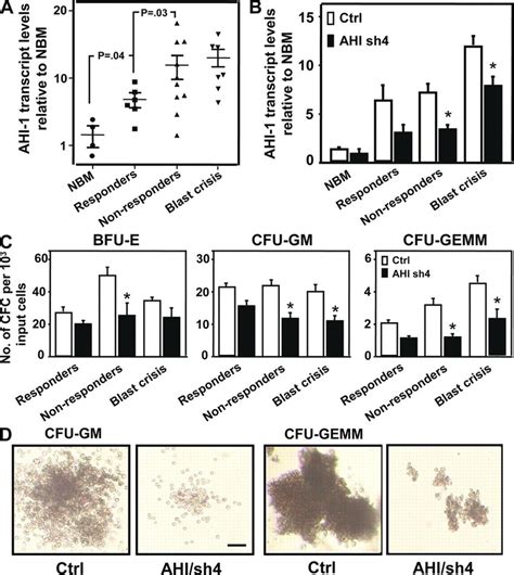 Elevated Ahi 1 Transcript Levels In Cml Stem Progenitor Cells And Download Scientific Diagram
