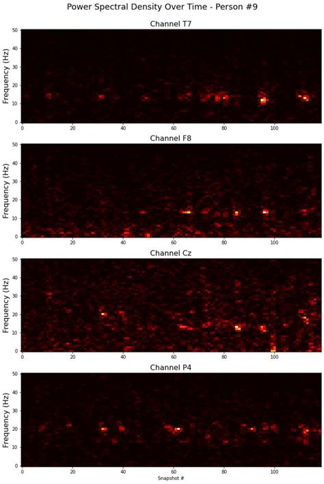 Minja Belić On Linkedin Biometrics Eeg
