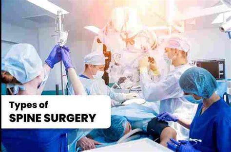 Advanced Spine Surgery Laminectomy TLIF Corpectomy And More DoctorsApp