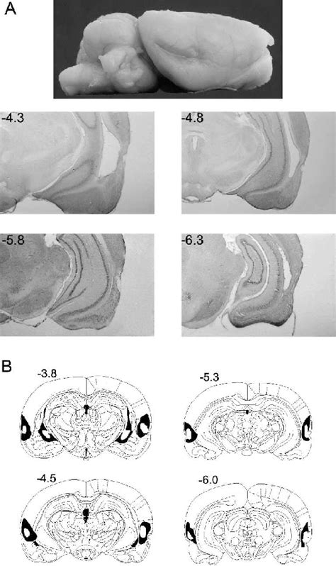 Figure 1 From Perirhinal Cortex Lesions Produce Retrograde Amnesia For Spatial Information In