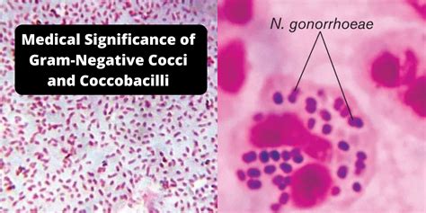Gram Negative Diplococci Stain Mixed Gram Positive And Gram Negative