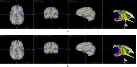 The Comparison Of Manual Labeling And The Corresponding Labelling Download Scientific Diagram