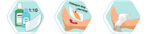 Обработка ран