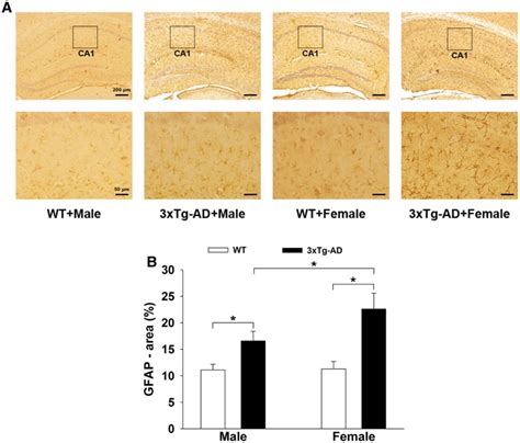 Sex Differences In Neuropathology And Cognitive Behavior In Appps1tau Triple Transgenic Mouse