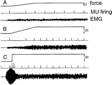 Emg And Single Motor Unit Firing Patterns Are Shown For Three Different