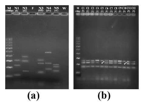 Gel Images Showing The Multiplex Pcr Products A Amplified Multiplex
