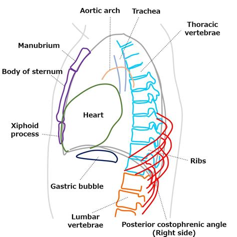 Chest Lateral ViewTools For RadTech