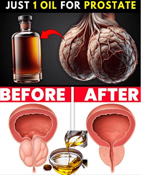 Just 1 Natural Oil To Shrink Enlarged Prostate 7 Natural Oils
