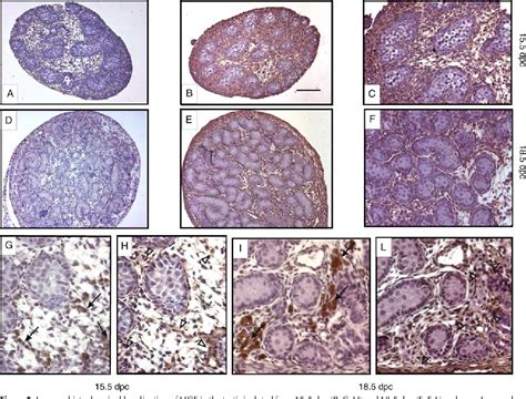 Figure 1 From Expression And Functional Role Of Hepatocyte Growth Factor And Its Receptor C Met