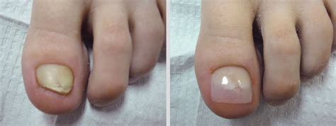 Three Ways To Transform The Appearance Of Your Toenails Podiatrist