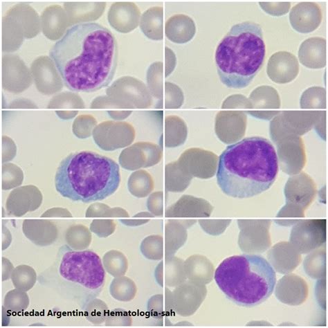 Sociedad Argentina De Hematología