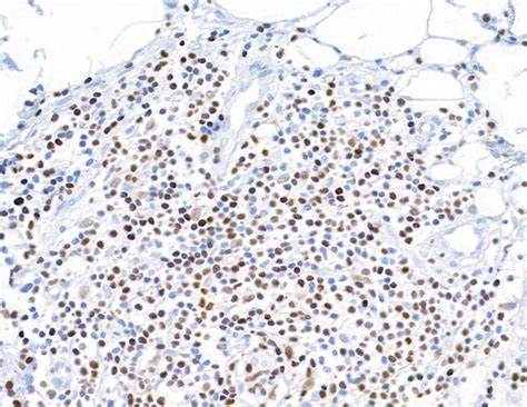 RUNX Recombinant Rabbit Monoclonal Antibody BLR H Invitrogen μL Fisher Scientific