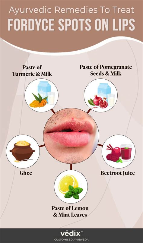 Natural Remedies Fordyce Spots