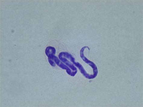 Microfilaria De O Volvulus En Extendido De Paaf Download Scientific