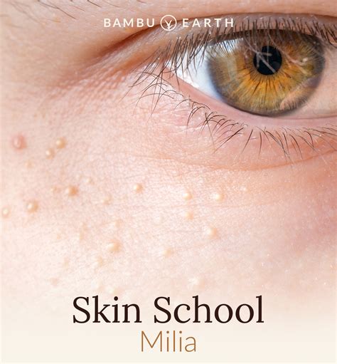 Bambu Earth Skin School Milia Milled