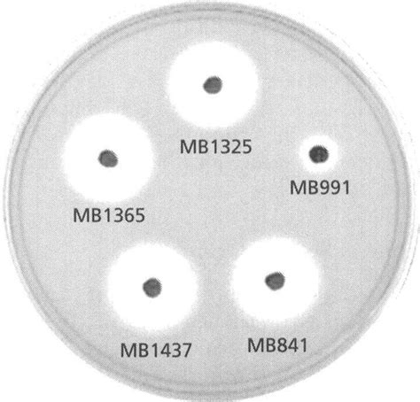 Detection Of Nuclease Activity On Dnase Test Agar Medium With Methyl