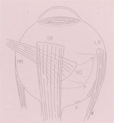 9 The Superior Oblique Ento Key