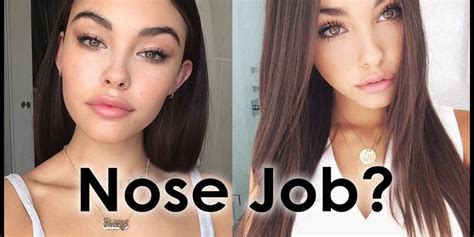 Madison Beers Aesthetic Evolution Subtle Procedures Stunning Results