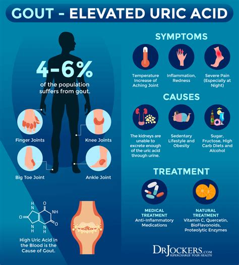 Causes Of Gout Acide Urique Et Goutte Prvoe