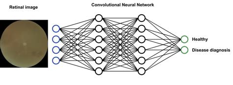 Automated Diagnosis Of 7 Retinal Diseases With Convolutional Neural
