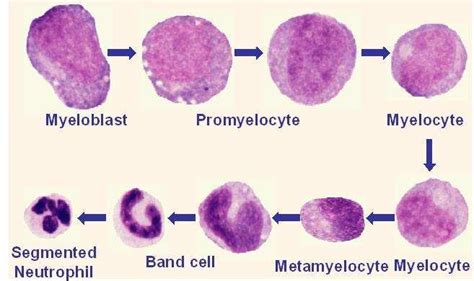 Neutrophilic Band