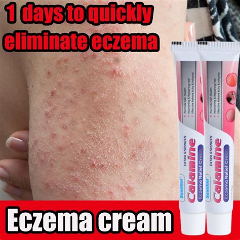 Eczema Cream Anti Itch Cream Antifungal Cream Remove Eczema 脫敏膏 Skin