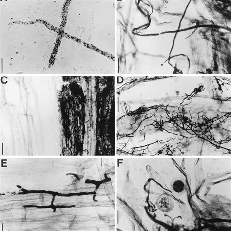 A Alkaline Phosphatase Alp Stained Hyphae Of Aphanomyces Euteiches
