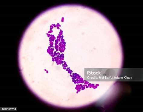 Photo Libre De Droit De Candida Spp Champignons Champignon