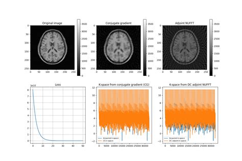 Reconstruction With Conjugate Gradient — Mri Nufft Documentation