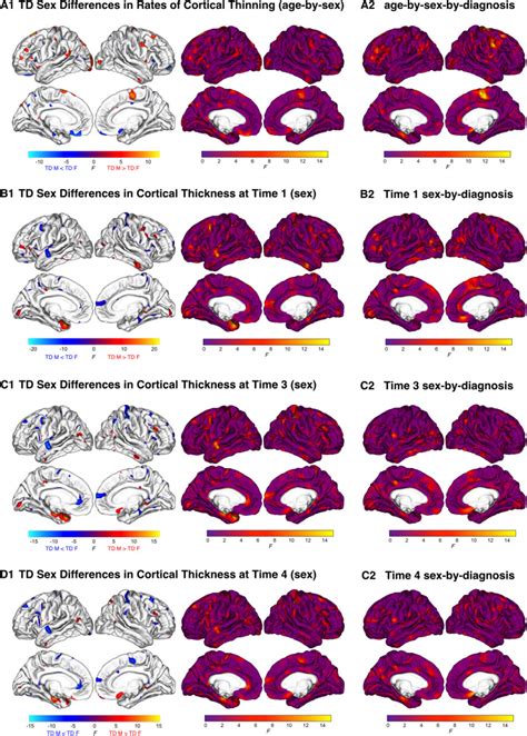 sex differences in trajectories of cortical development in autistic