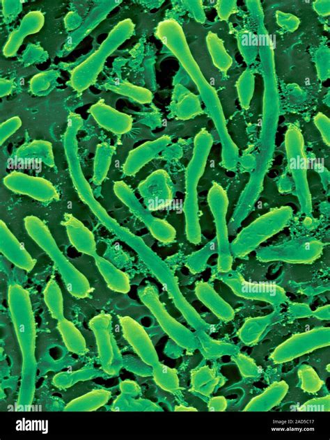 Coloured Scanning Electron Micrograph Sem Of Halophilic Archaea Prokaryote This Pleomorphic