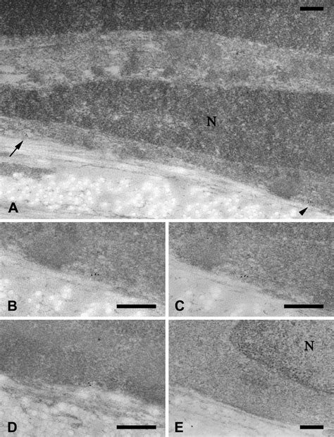 Immunoelectron Microscopic Analyses Of Trpv4 In The Mouse Urothelium Download Scientific
