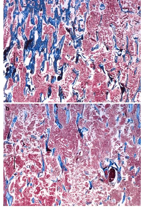 Trabecular Bone In The Proximal Tibial Metaphysis Of 16month Old Male Download Scientific