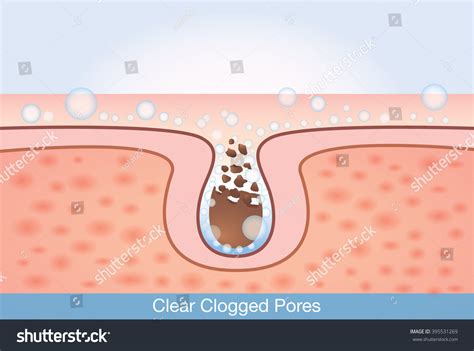 Deep Cleaning Unclog Pores This Illustration Stock Vector Royalty Free 395531269