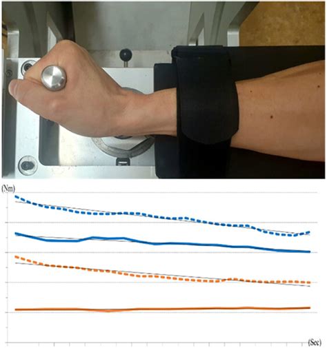 Pathophysiology Of Sex Difference In Refractoriness In Lateral