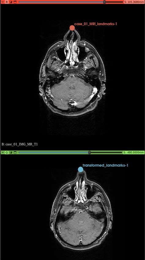 Marker Registration Does Not Follow Image Registration Beginner