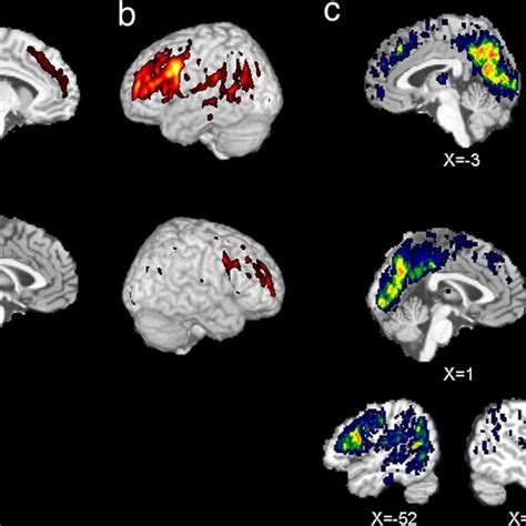 Resting State Brain Activity In Chimpanzees The Five Percent Most