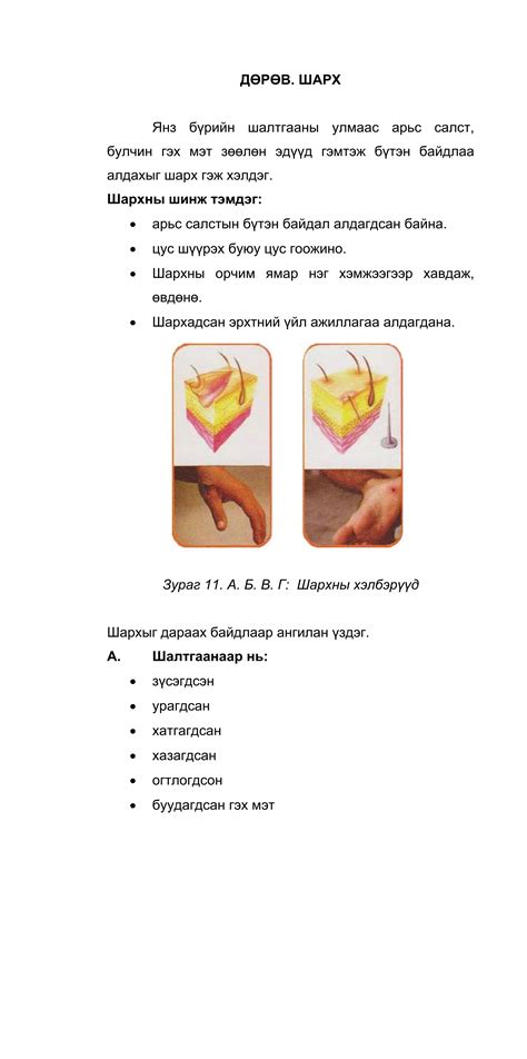 Осол гэмтлийн үед үзүүлэх анхны тусламж Pdf