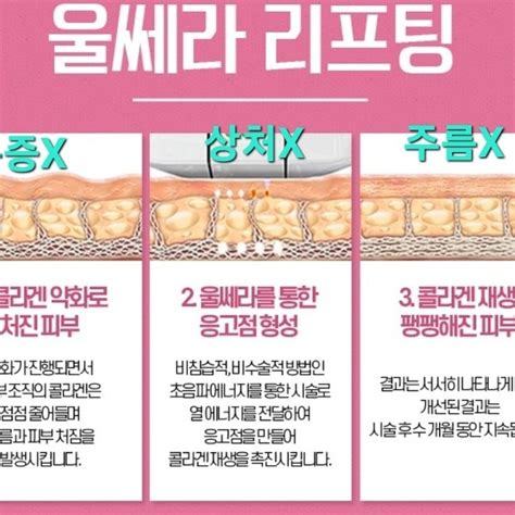 💞울쎄라 리프팅 효과ㆍ가격ㆍ후기 ㆍ부작용 서울특별시 양천구 신정동 비즈프로필