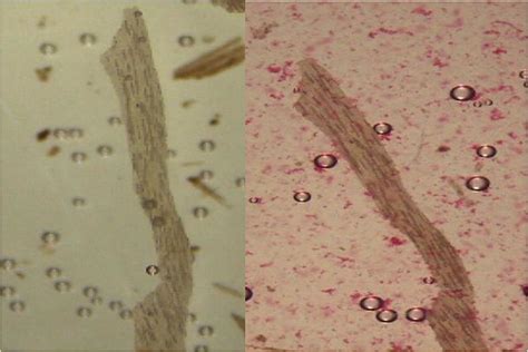Image Of A Potential Microplastics In Prepared Sediment Sample Which Download Scientific