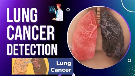 Github Projects Developerlung Cancer Detection System Using Machine