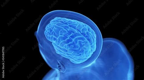 3d Rendered Medical Animation Of A Degenerating Brain Stock Video