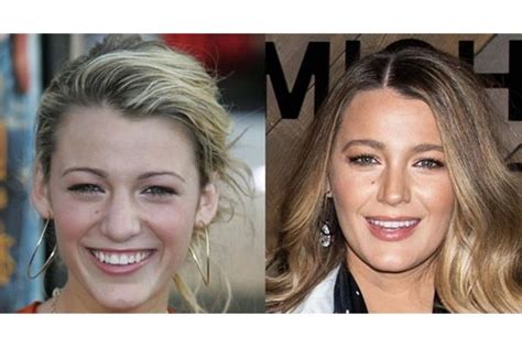 Celebrity Noses 60 Photos Moonagedaydream Film