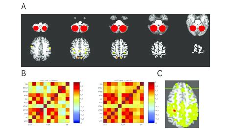 Resting State Connectivity Correlations A The 11 Regions Of