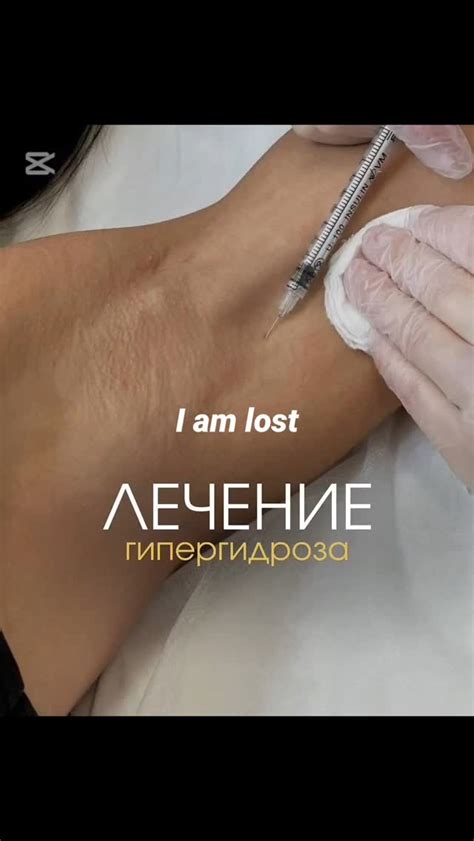 КОСМЕТОЛОГ АЛМАТЫ БОТОКС ФУЛЛФЕЙС МОНАКО Smo • Instagram Photos And Videos