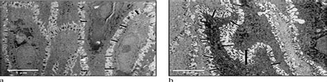 Dilated Intercellular Spaces Of Esophageal Epithelium In Non Official Journal Of The